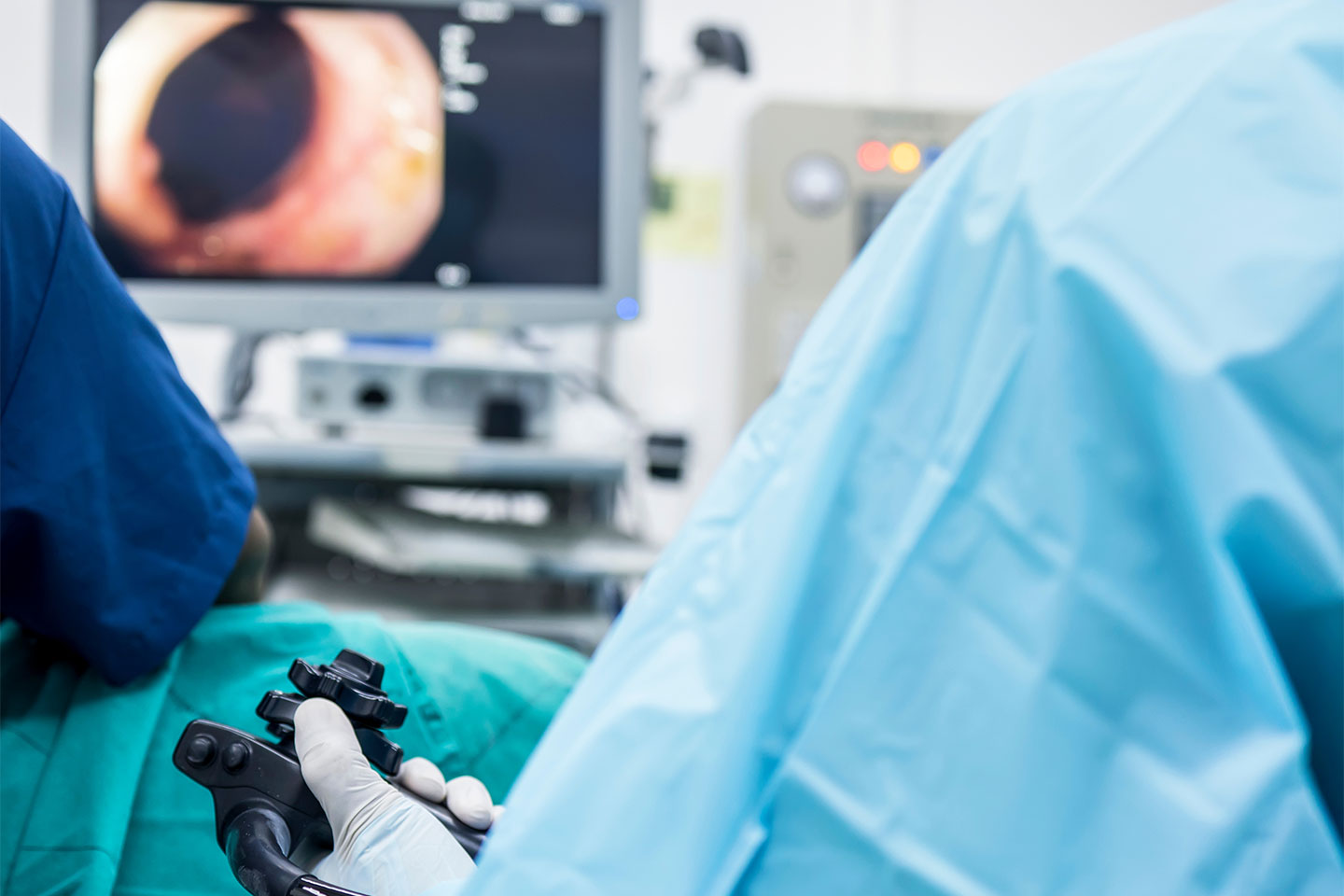 Colonoscopy FAQ: What Do The Results Mean? | News & Stories ...